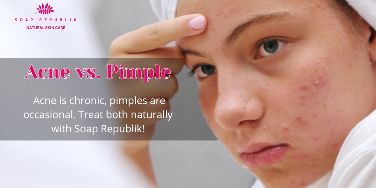 Acne vs Pimple : Understanding the Difference and How Soap Republik Can ...